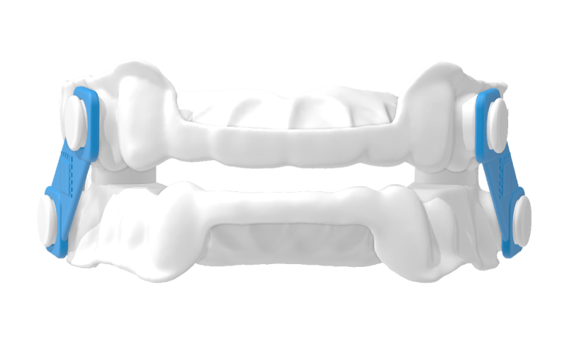 Sleep Apnea Dental Devices – Indy Sleep Apnea